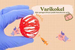 Varikokel - Penyebab, Gejala dan Cara Mengobatinya