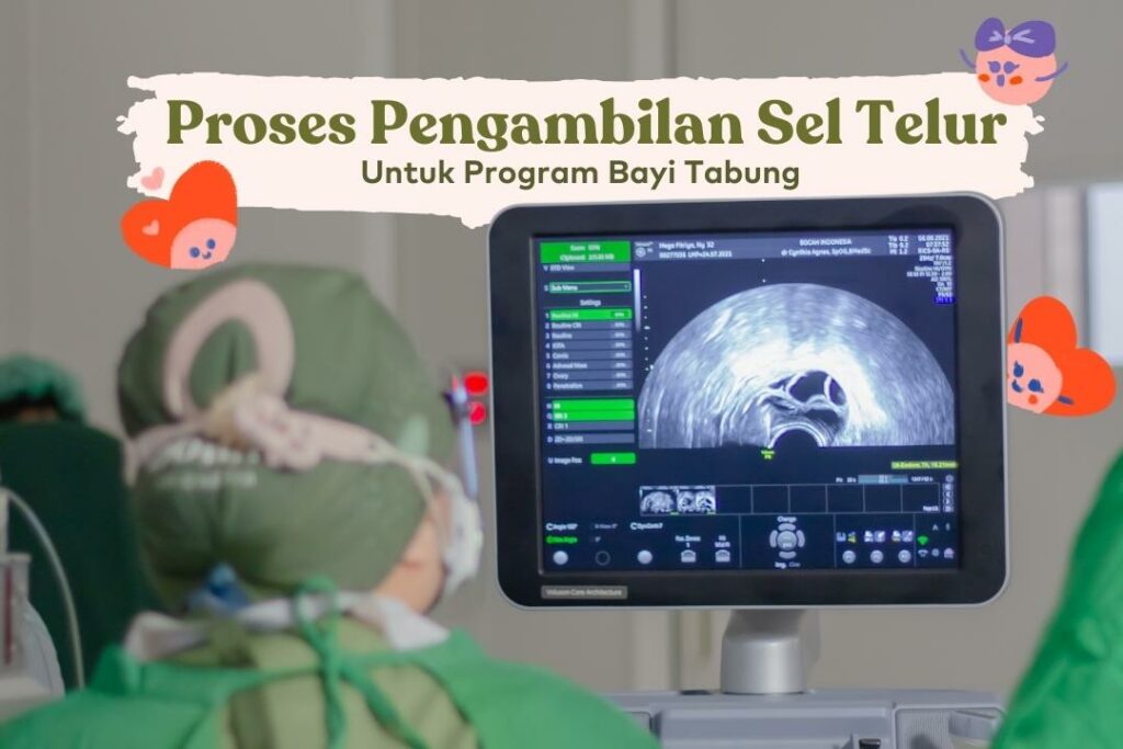 Bagaimana Proses Pengambilan Sel Telur untuk Bayi Tabung?