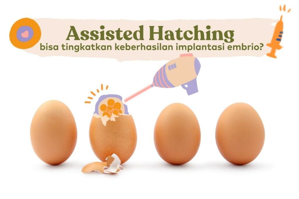 Assisted Hatching : Penjelasan, Tujuan, Prosedur, Metode