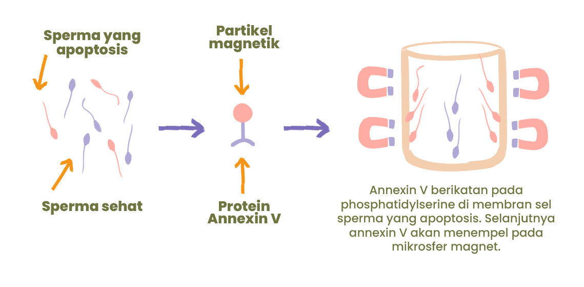 Apa itu Teknik MCAS pada program IVF bayi tabung