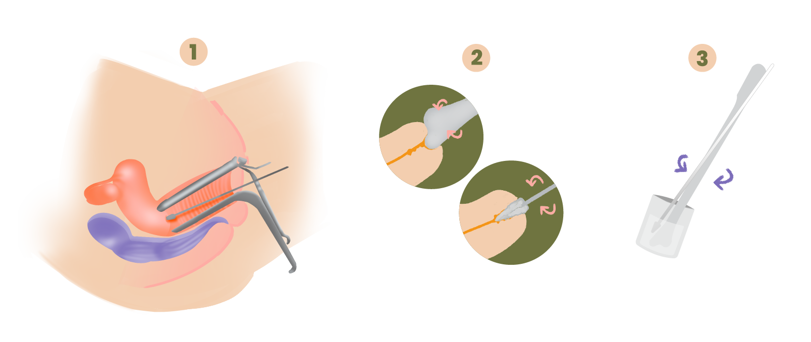 Pap Smear Pengertian Tujuan Dan Kegunaan