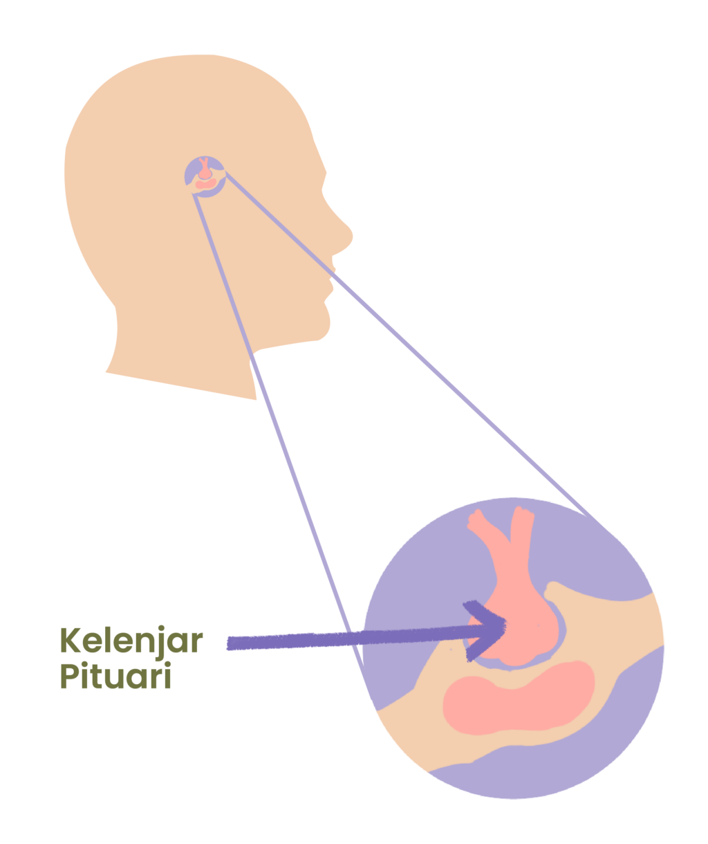 Apa itu hiperprolaktinemia dan apa Efek pada Kesuburan