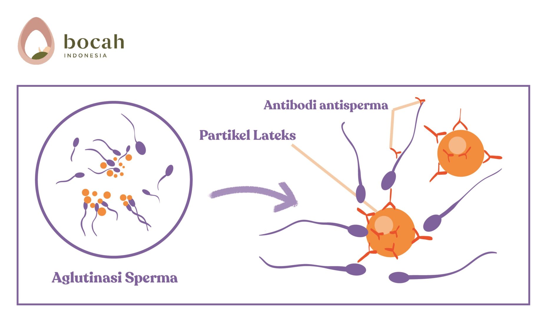 Sperm Agglutination on Male Fertility