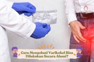 Cara Mengobati Varikokel Bisa Dilakukan Secara Alami?
