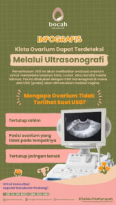 Kista Ovarium Dapat Terdeteksi Melalui Ultrasonografi