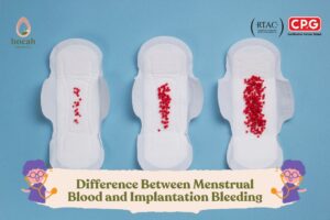 Implantation Bleeding vs. Period: Know the Signs of Pregnancy